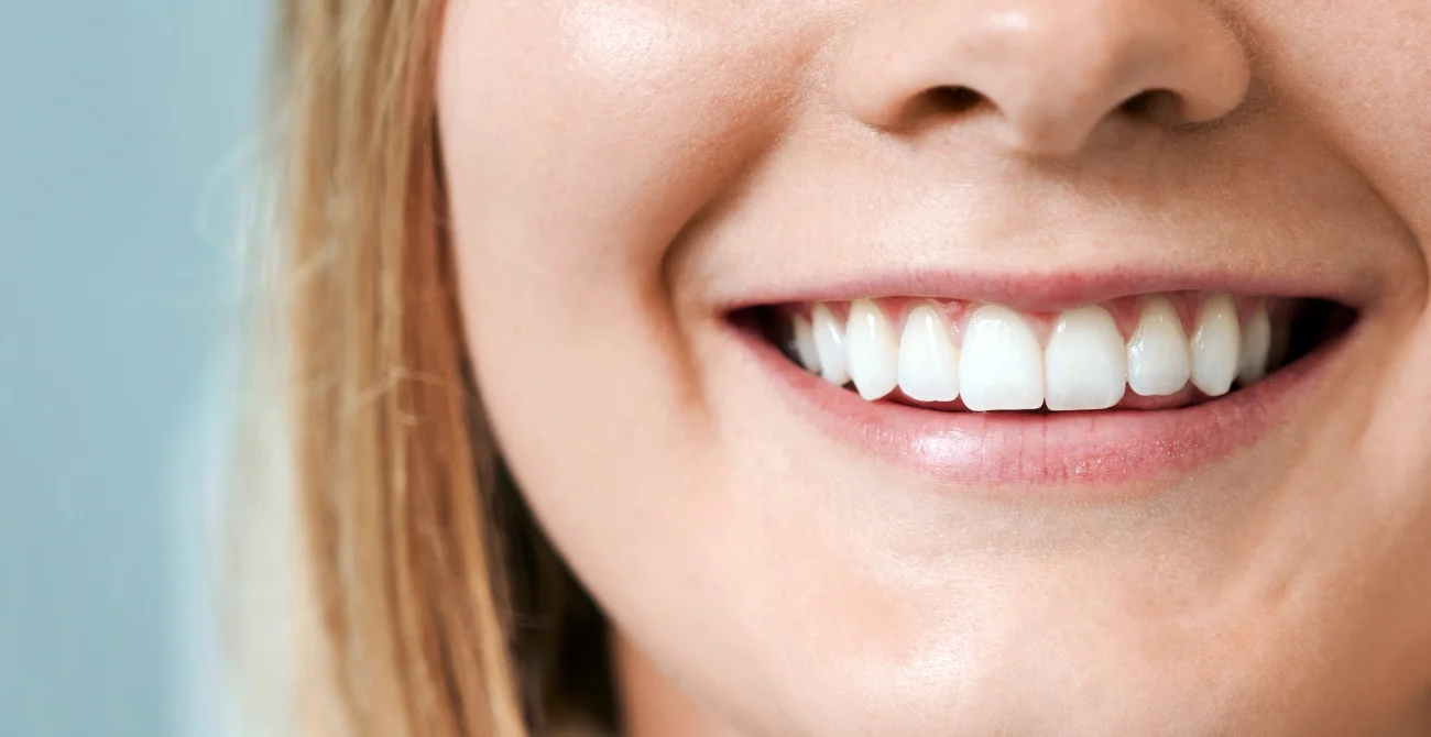 Get a confident smile with Teeth Whitening - Teeth Whitening in Baildon